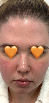 SKINtamin® | Vitamin for Skin Health & Collagen Support – HAIRtamin