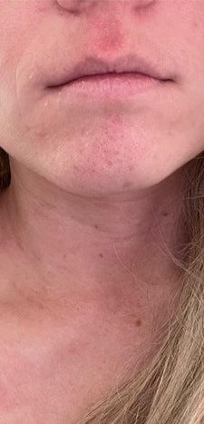 SKINtamin® | Vitamin for Skin Health & Collagen Support – HAIRtamin