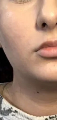 SKINtamin® | Vitamin for Skin Health & Collagen Support – HAIRtamin