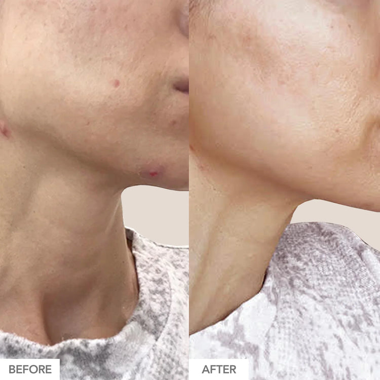 SKINtamin® | Vitamin for Skin Health & Collagen Support – HAIRtamin